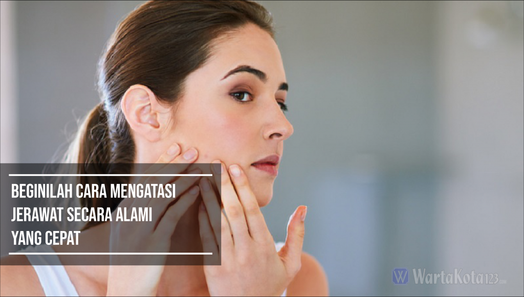 Beginilah Cara Mengatasi Jerawat Secara Alami yang Cepat