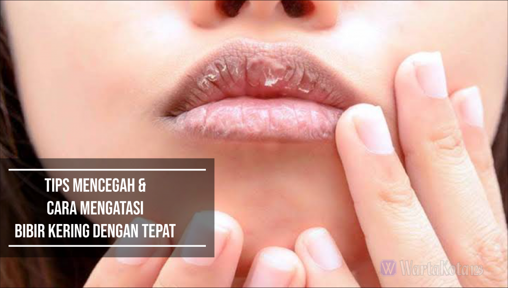 Tips Mencegah & Cara Mengatasi Bibir Kering dengan Tepat